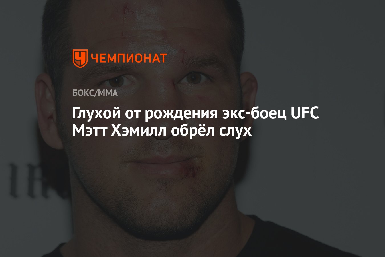 Глухой от рождения экс-боец UFC Мэтт Хэмилл обрёл слух - Чемпионат