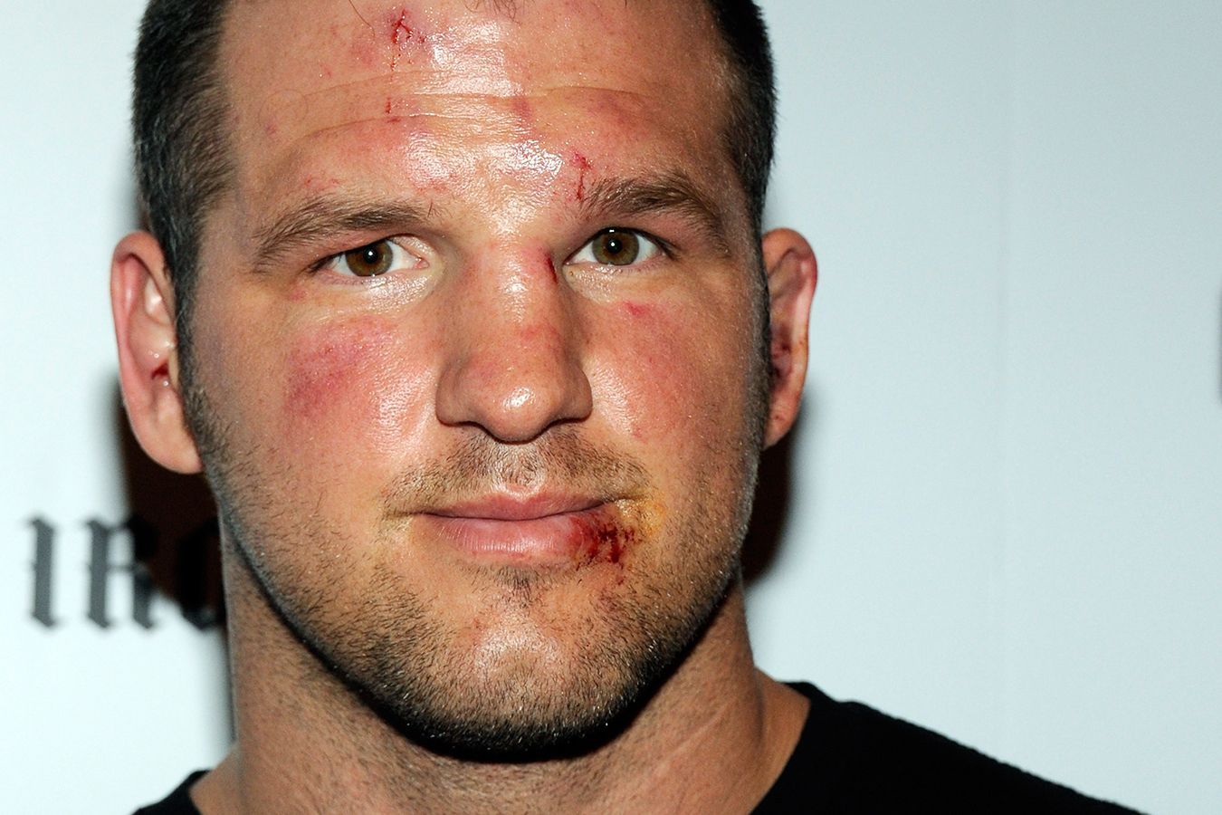 Глухой от рождения экс-боец UFC Мэтт Хэмилл обрёл слух - Чемпионат